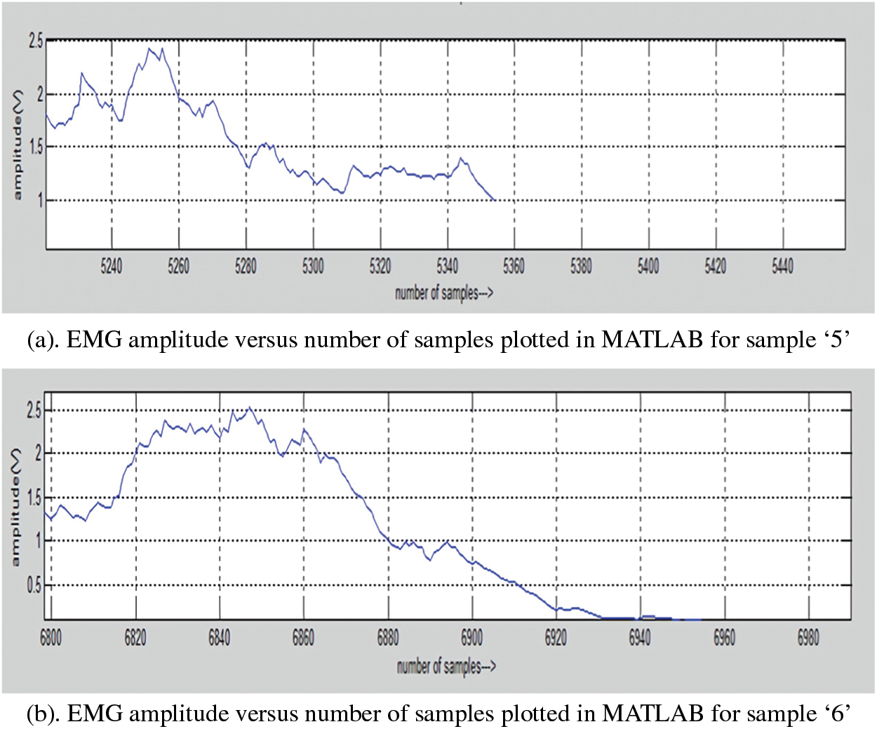 Real Time Monitoring of Muscle Fatigue with IoT and Wearable Devices