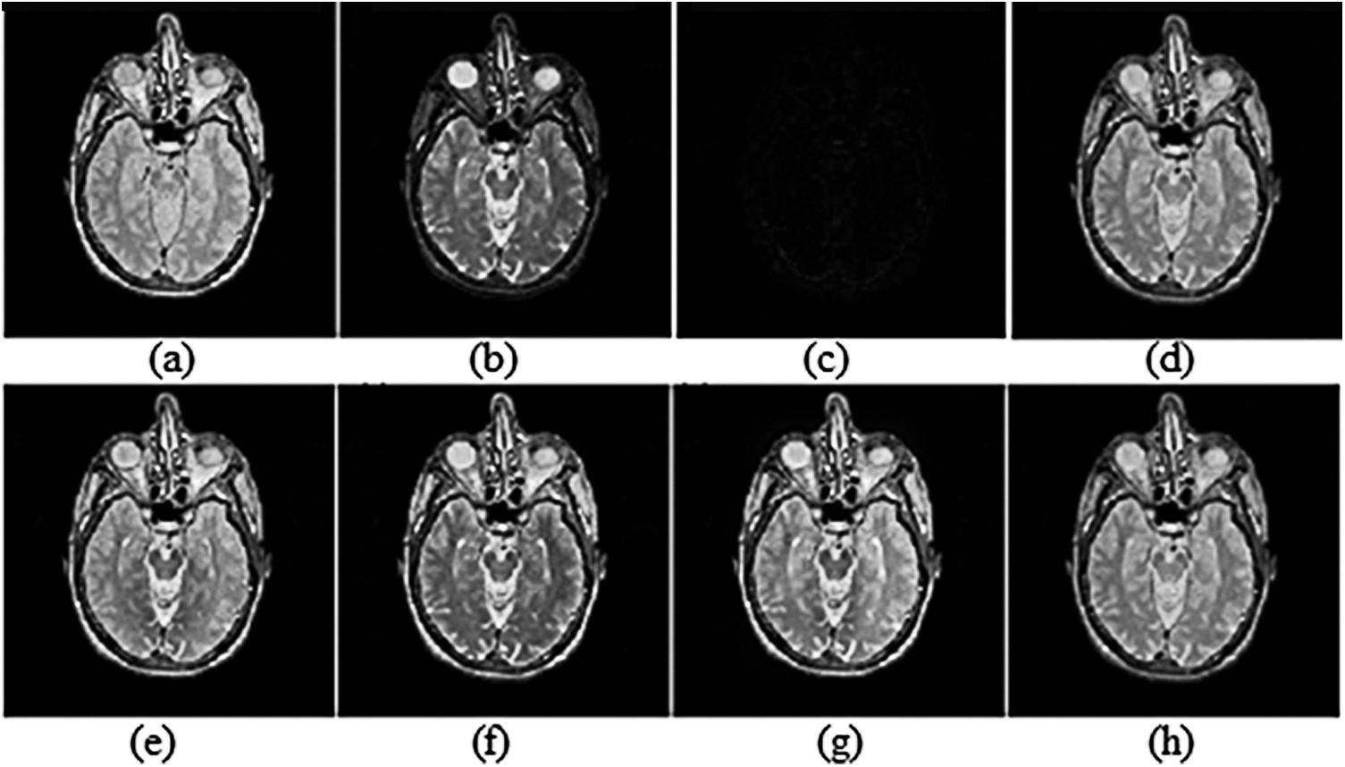 Multimodal Medical Image Registration and Fusion for Quality Enhancement