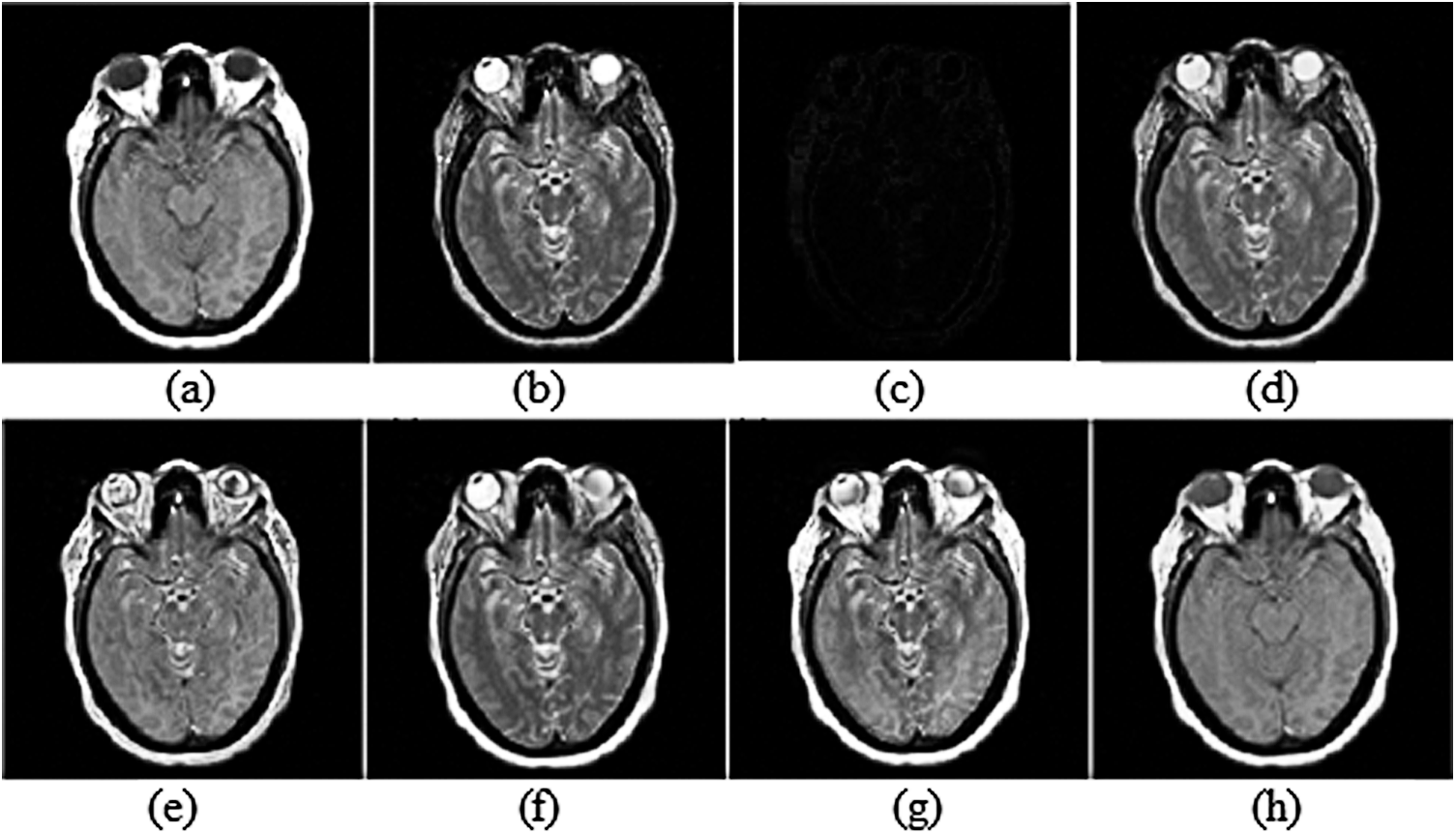 Multimodal Medical Image Registration and Fusion for Quality Enhancement