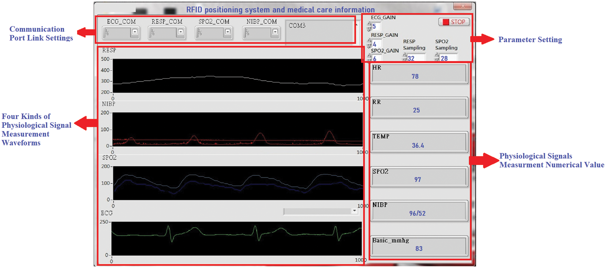 RFID Positioning and Physiological Signals for Remote Medical Care